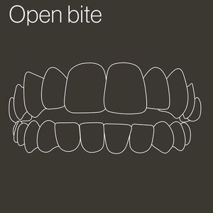 Invisalign in Mississauga, ON | Teeth Straightening Near You